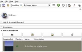 Slicer4:VisualBlog - Slicer Wiki
