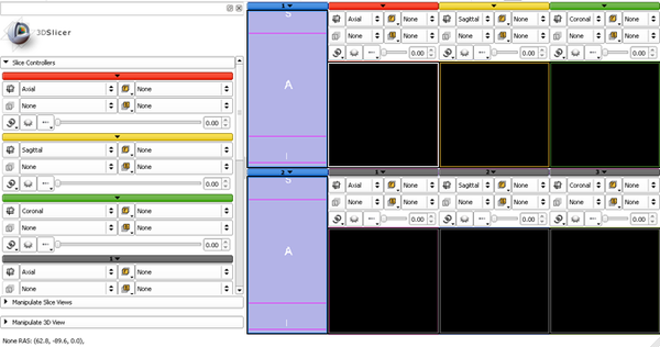 Slicer4:ViewerDesign - Slicer Wiki