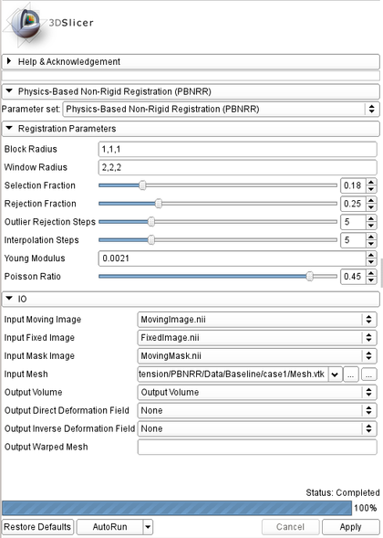 Documentation/Nightly/Extensions/PBNRR - Slicer Wiki