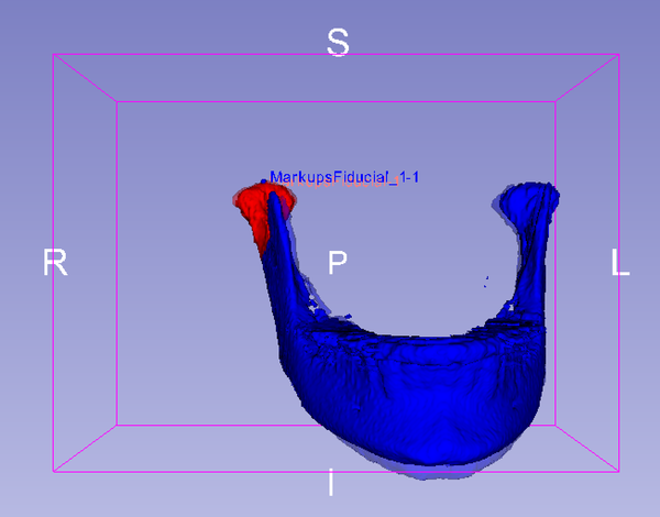 Documentation/4.6/Modules/SurfaceRegistration - Slicer Wiki