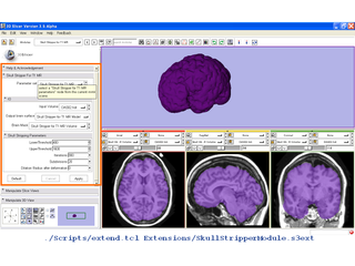Slicer3:VisualBlog - Slicer Wiki