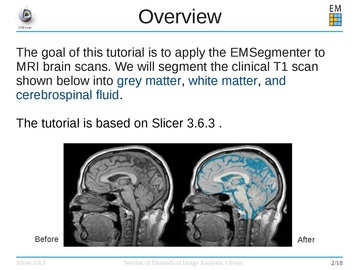 File:EMSegmenterTutorialSimpleMode-Slicer-3.6.3-1.pdf - Slicer Wiki