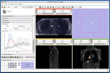Slicer3:VisualBlog - Slicer Wiki