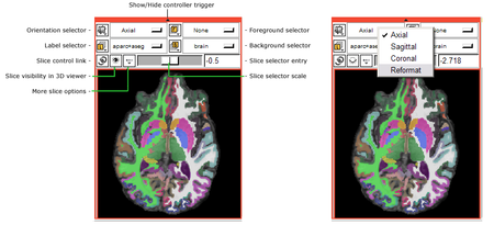 Modules:MainApplicationGUI-Documentation-3.4 - Slicer Wiki