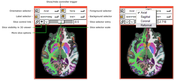 Modules:MainApplicationGUI-Documentation - Slicer Wiki