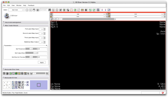 Modules:AtlasCreator-Documentation-3.5 - Slicer Wiki