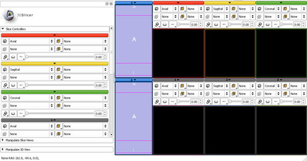 Slicer4:ViewerDesign - Slicer Wiki