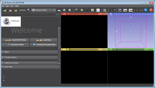Documentation/4.3/Announcements - Slicer Wiki