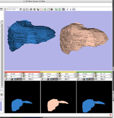 Slicer3:VisualBlog - Slicer Wiki