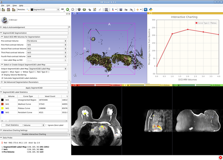 Documentation/Nightly/Modules/SegmentCAD - Slicer Wiki