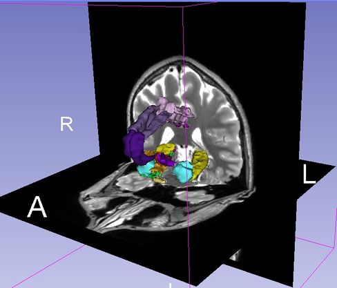 Documentation/4.3/Modules/FacetedVisualizer - Slicer Wiki