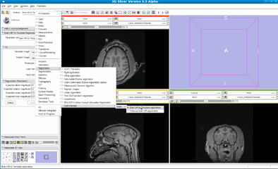 Slicer3:VisualBlog - Slicer Wiki