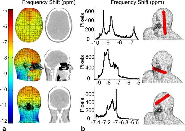 Main Page/SlicerCommunity/2018 - Slicer Wiki