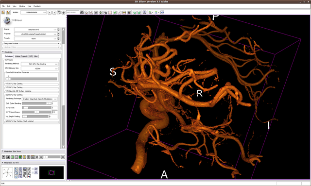Modules:VolumeRendering-Documentation-3.6 - Slicer Wiki