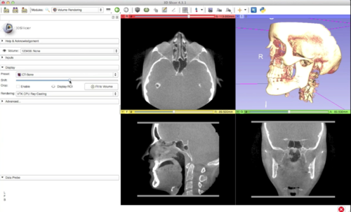 Documentation/4.8/Training - Slicer Wiki
