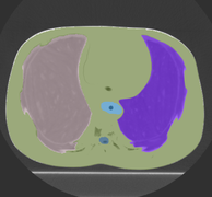 Documentation/4.5/Extensions/Plastimatch - Slicer Wiki