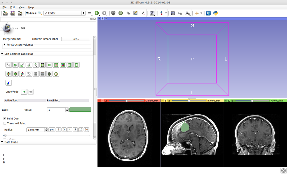 Documentation/4.5/Extensions/CarreraSliceInteractiveSegmenter - Slicer Wiki